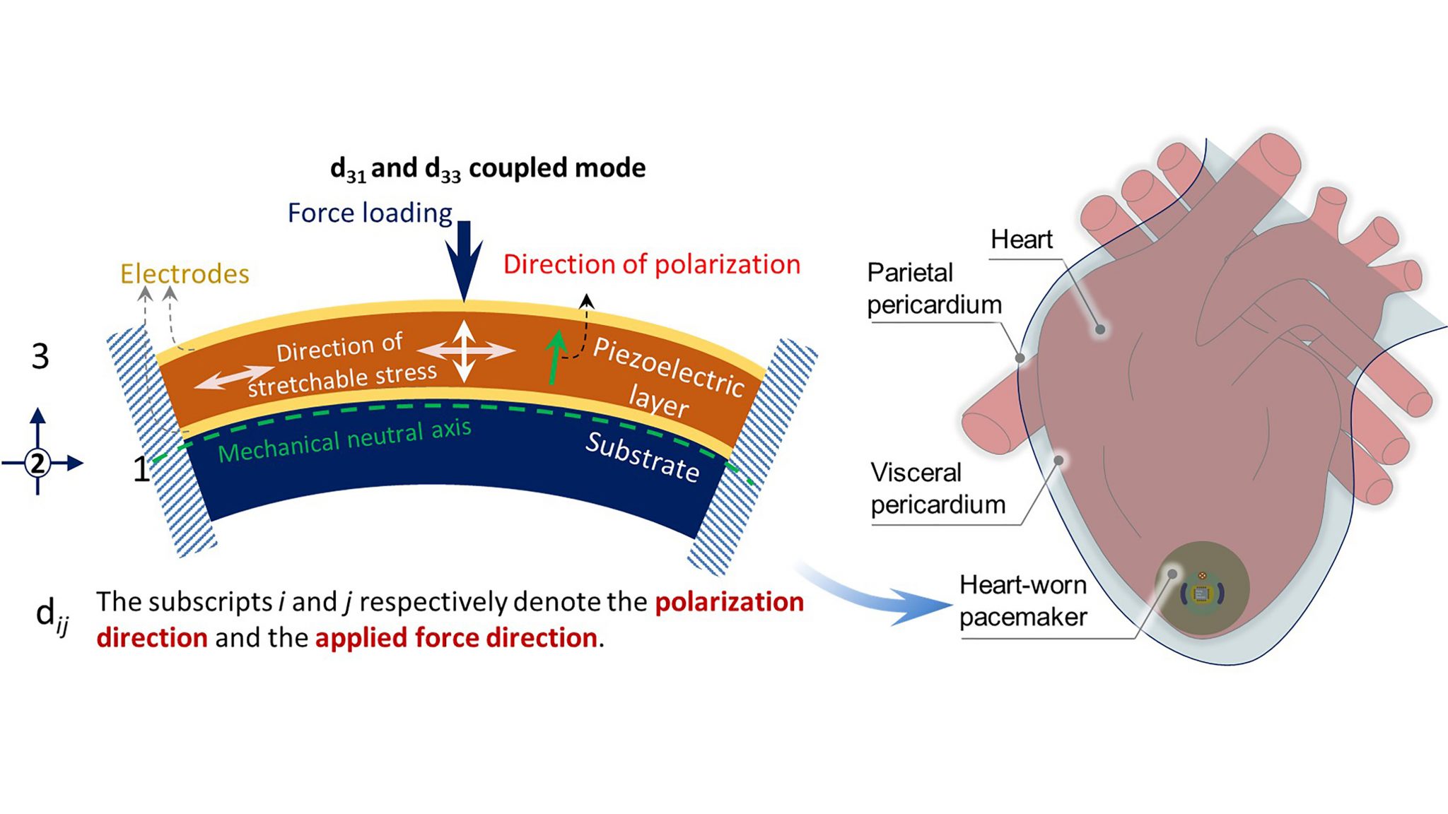 Batteryless Pacemaker Could Use Heart's Energy for Power - AIP ...