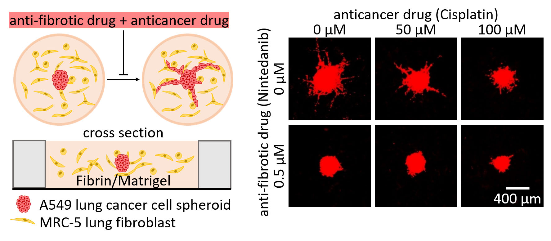Fibroblast Inhibitors Assist Anti-Cancer Drugs to Suppress Cancer ...