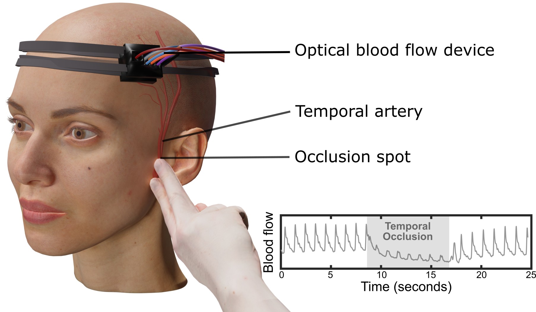 Wearable Optical Device Distinguishes Blood Flow Signals From the Brain ...